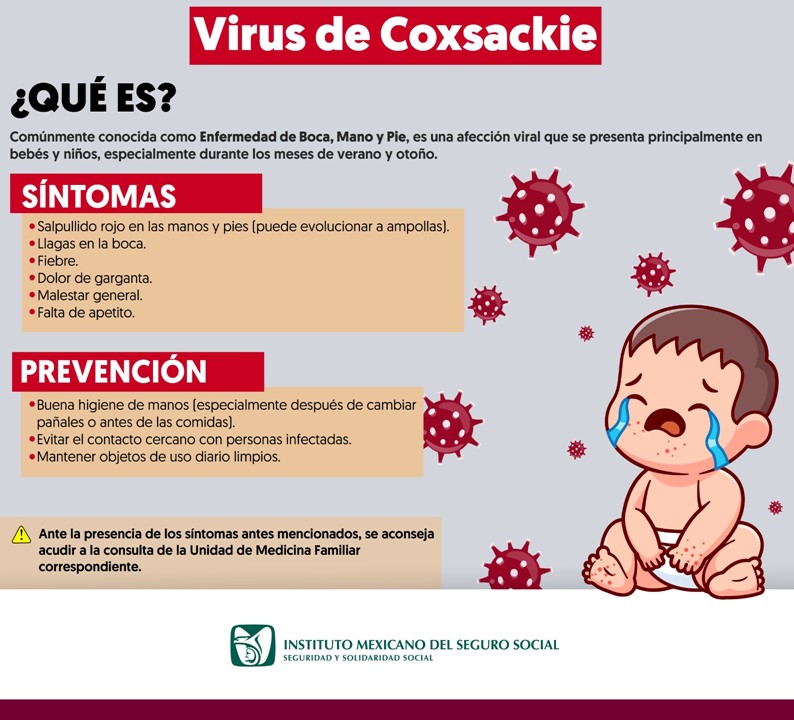 Previene IMSS Hidalgo de síntomas por Virus de Coxsackie ...